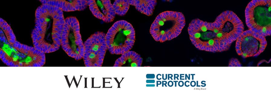 Overview - Intestinal Organoids - Organoid Research - Areas of Interest ... Overview - Intestinal Organoids - Organoid Research - Areas of Interest ...